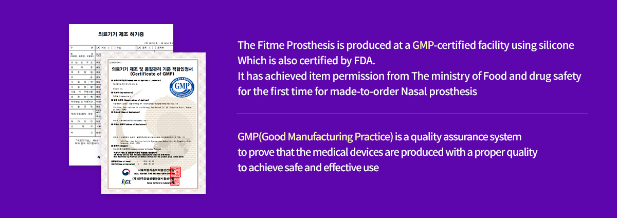 Custom prosthesis Perialar augmentaion - GNG Hospital, Plastic surgery ...