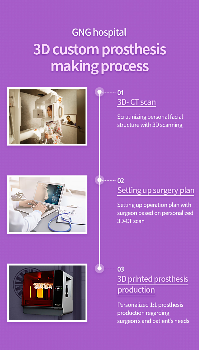 Custom prosthesis Perialar augmentaion - GNG Hospital, Plastic surgery ...