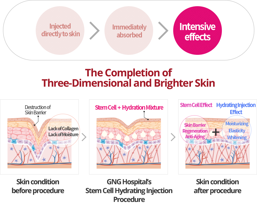 Stem Cell Hydro Injection, Skin Barrier restoration - GNG Hospital ...