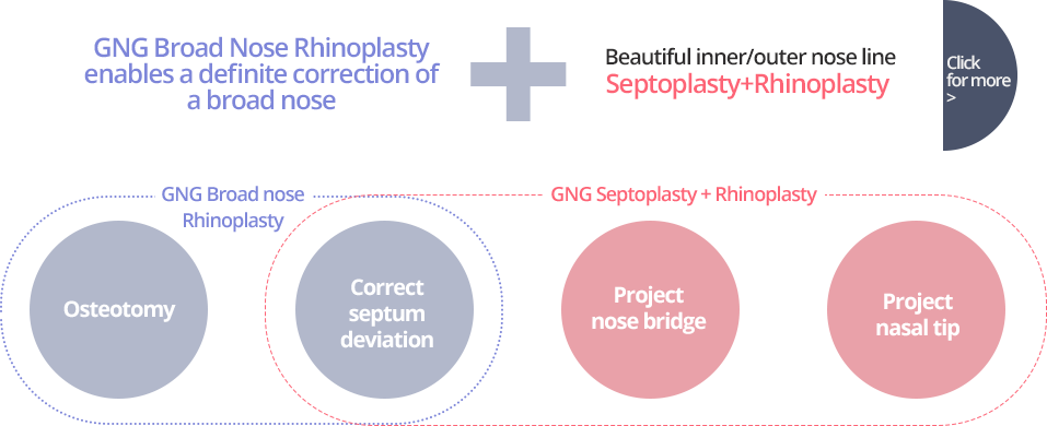 Broad nose, Low-bridged nose - GNG Hospital, Plastic surgery, ENT.